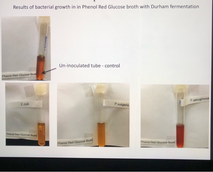 Solved Observation Observe media color and note presence of | Chegg.com
