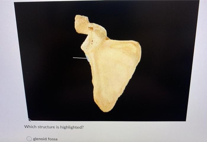 Solved Which structure is highlighted? Oglenoid fossa | Chegg.com