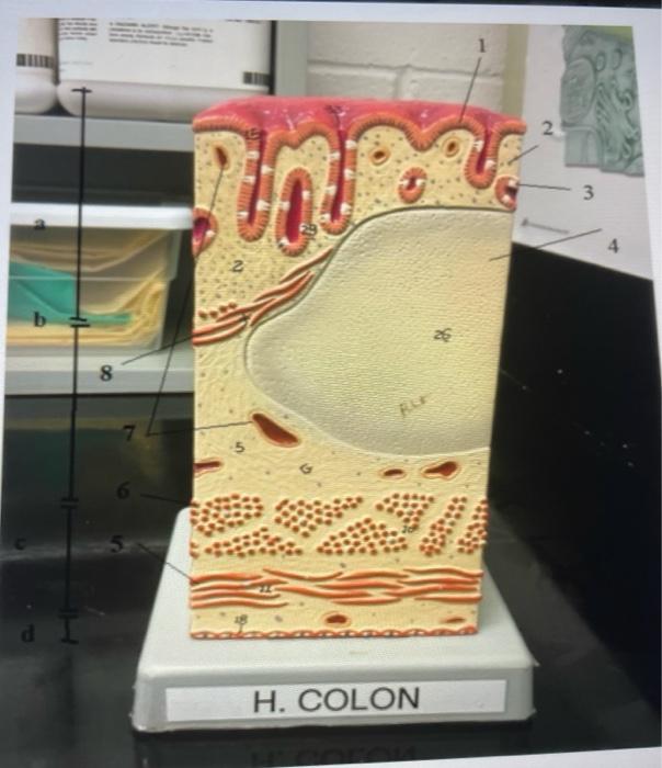 Solved Identify the organ. Label the layers and components | Chegg.com