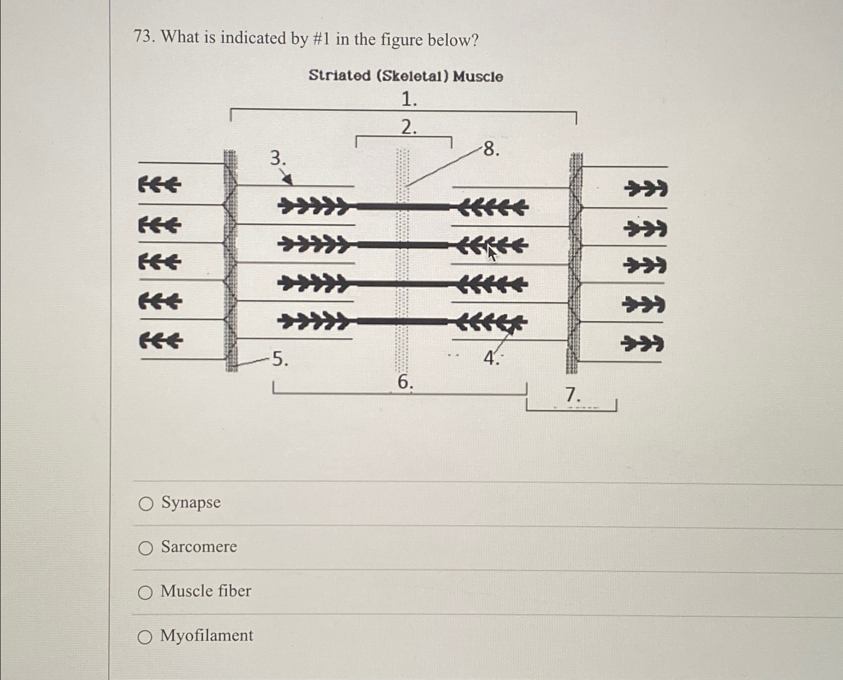 Solved What is indicated by #1 ﻿in the figure below?Striated | Chegg.com