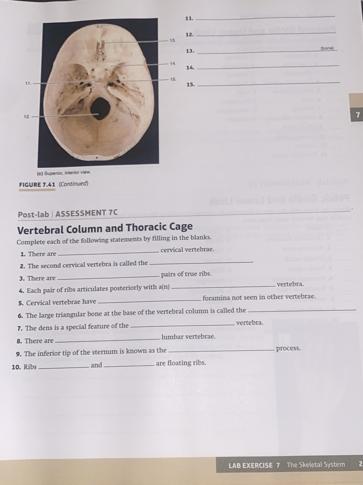 Solved Post-lab ASSESSMENT 7 ﻿BThe SkullComplete the | Chegg.com
