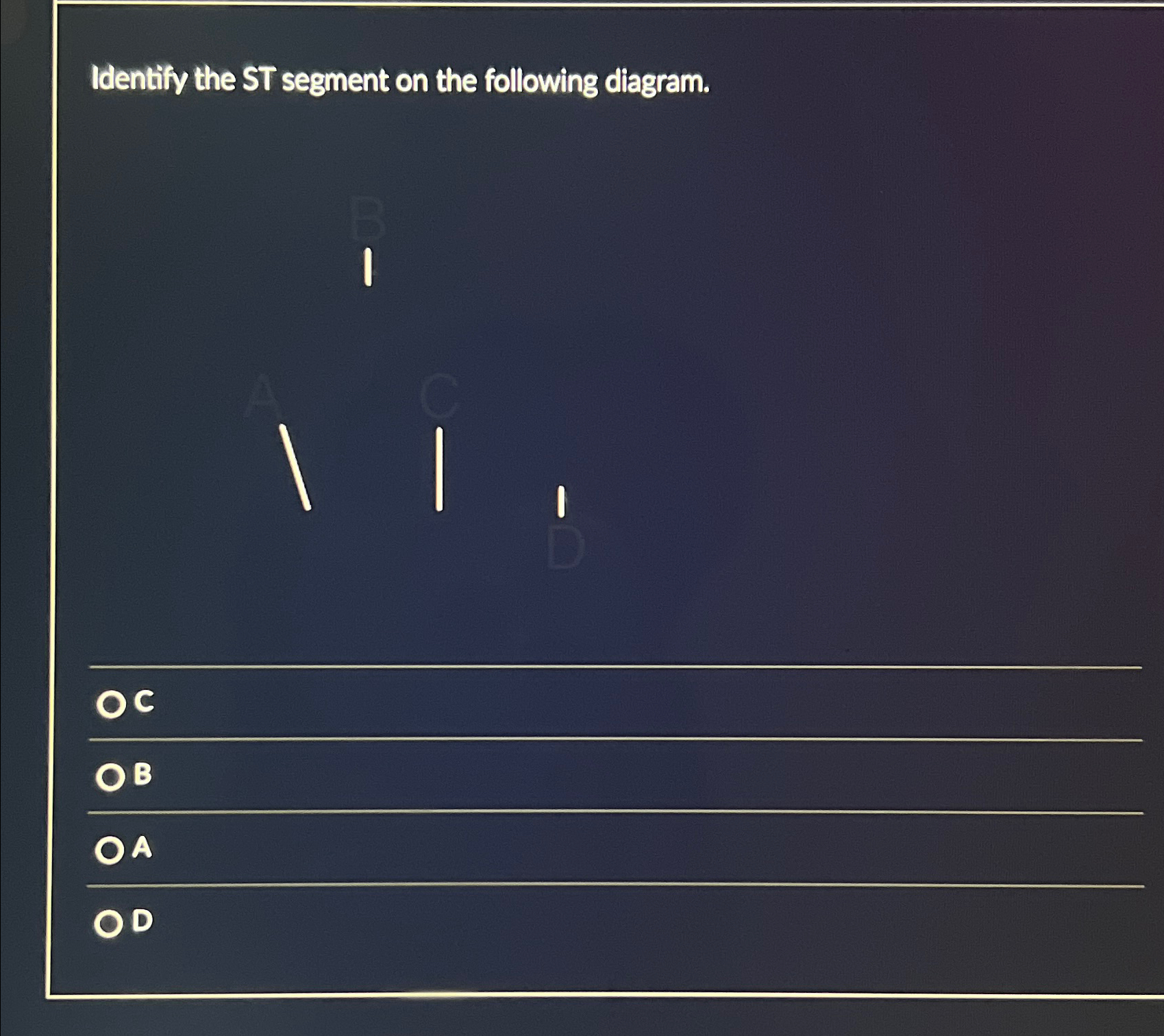 Solved Identify the ST segment on the following | Chegg.com