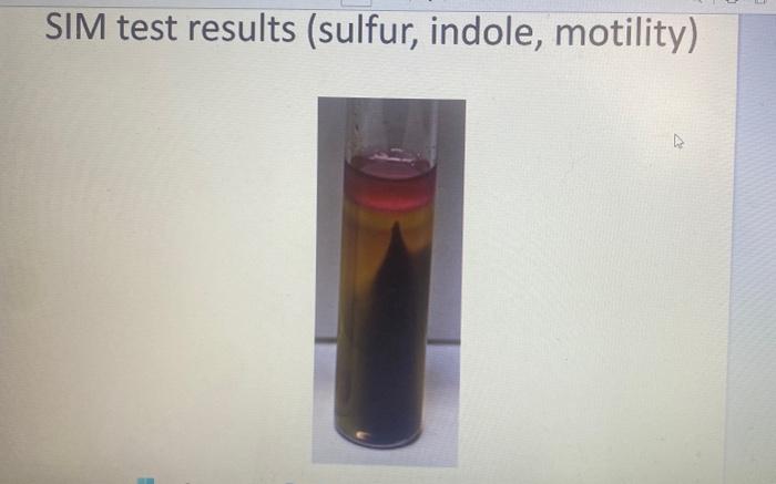 Solved SIM test results (sulfur, indole, motility) | Chegg.com