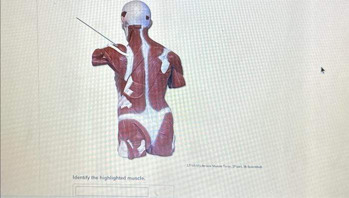 Solved Identify the highlighted muscle. | Chegg.com