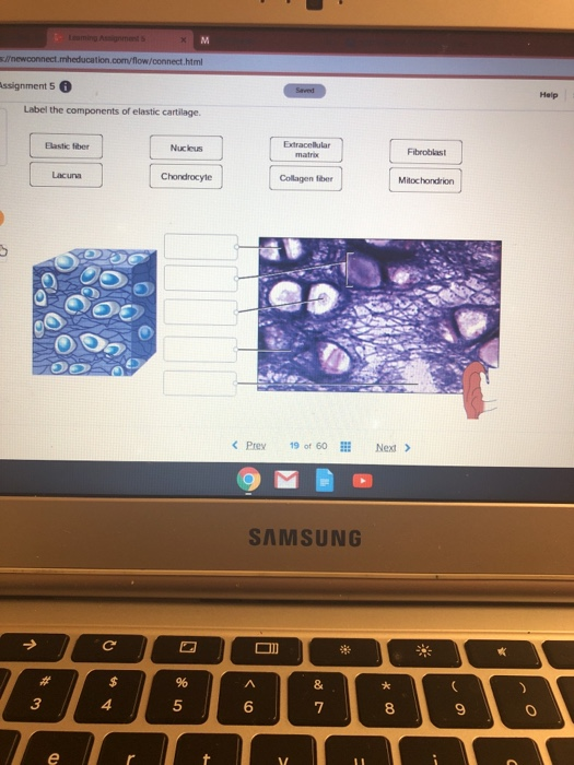 Solved newconnect. education.com/flow/connect him assignment | Chegg.com