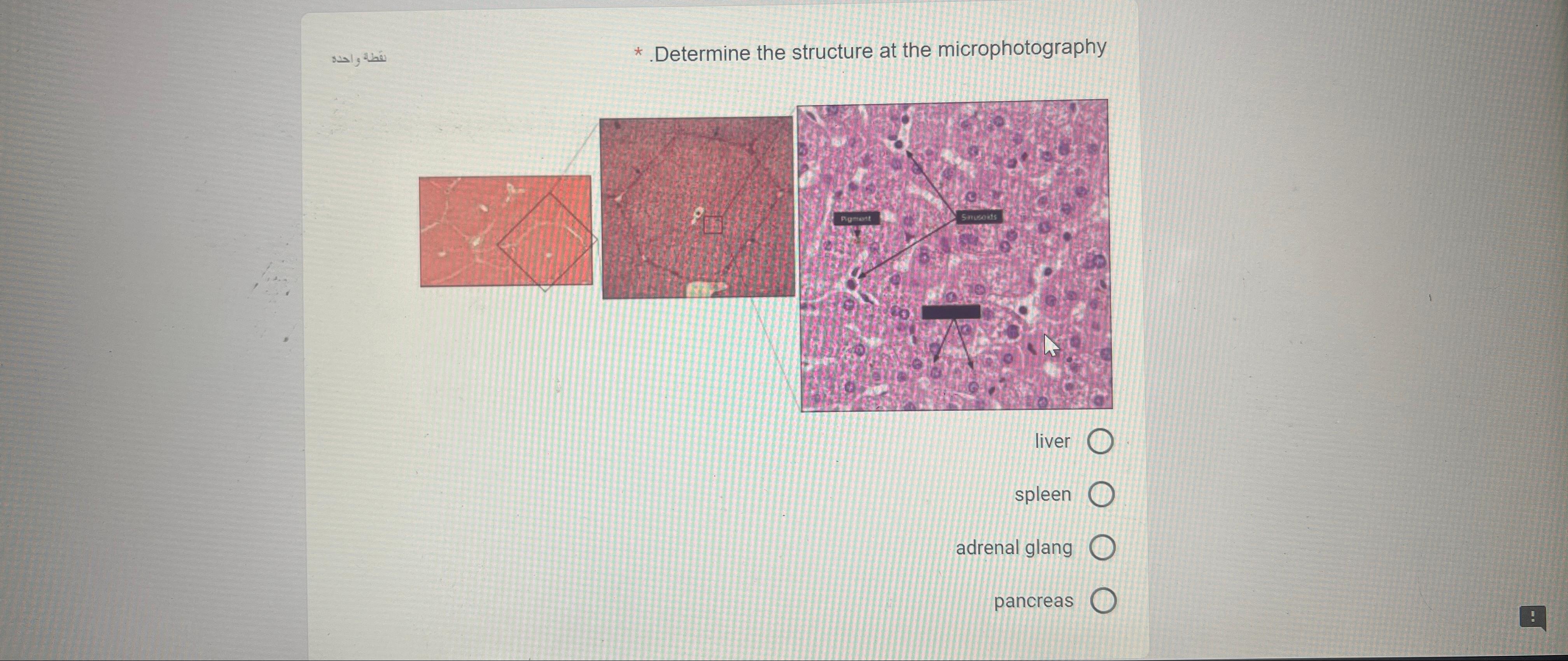 Solved *. ﻿Determine the structure at the | Chegg.com