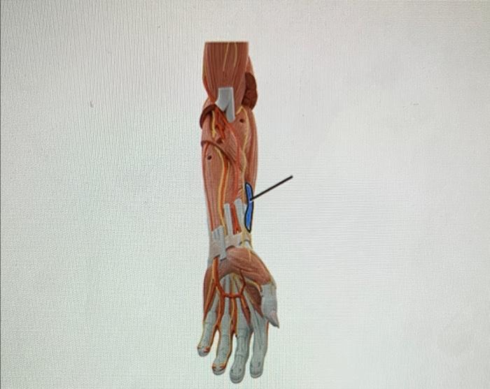 Solved O Supinator O Pronator teres (cut on model) Flexor | Chegg.com