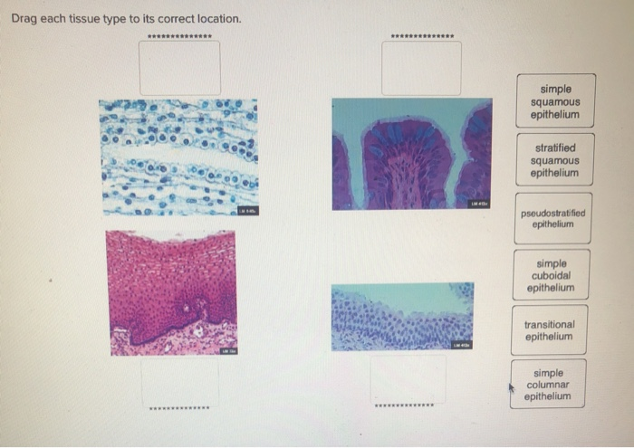 Solved Drag each tissue type to its correct location. simple | Chegg.com Solved Drag each tissue type to its correct location. simple | Chegg.com