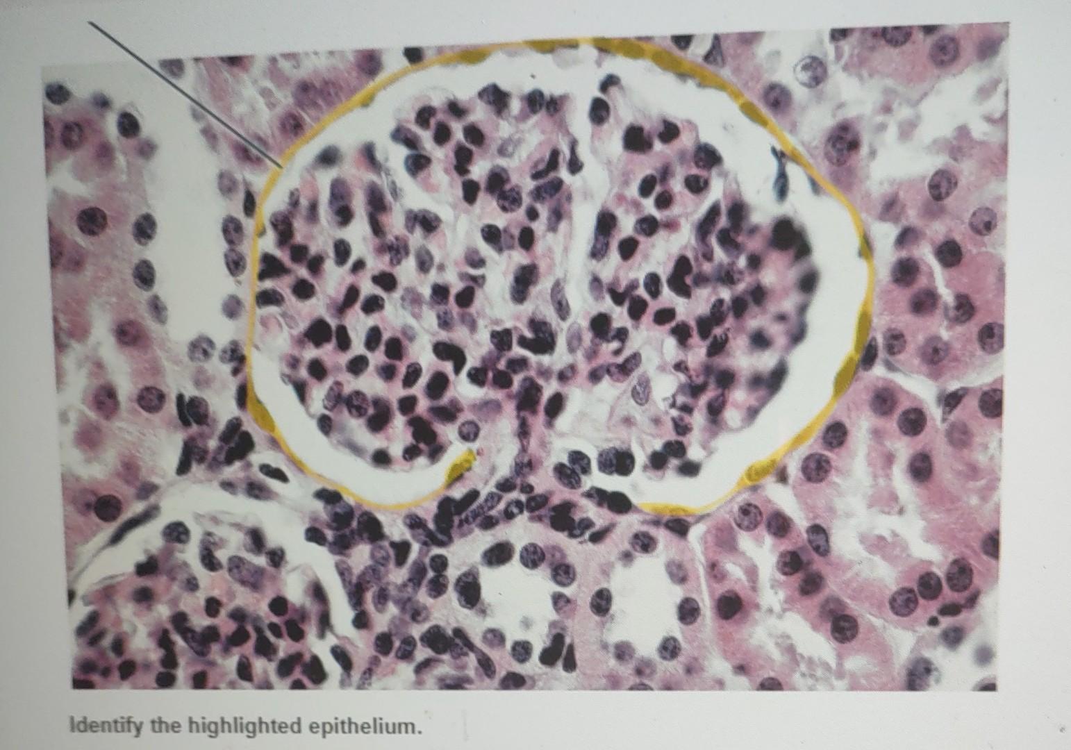 Solved Identify the highlighted epithelium. | Chegg.com