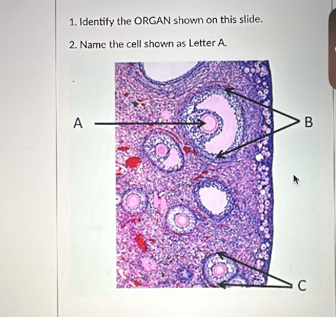 Solved Identify the ORGAN shown on this slide.Name the cell | Chegg.com