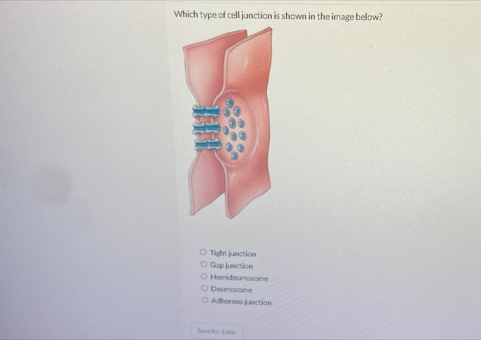 Solved Which type of cell junction is shown in the image | Chegg.com