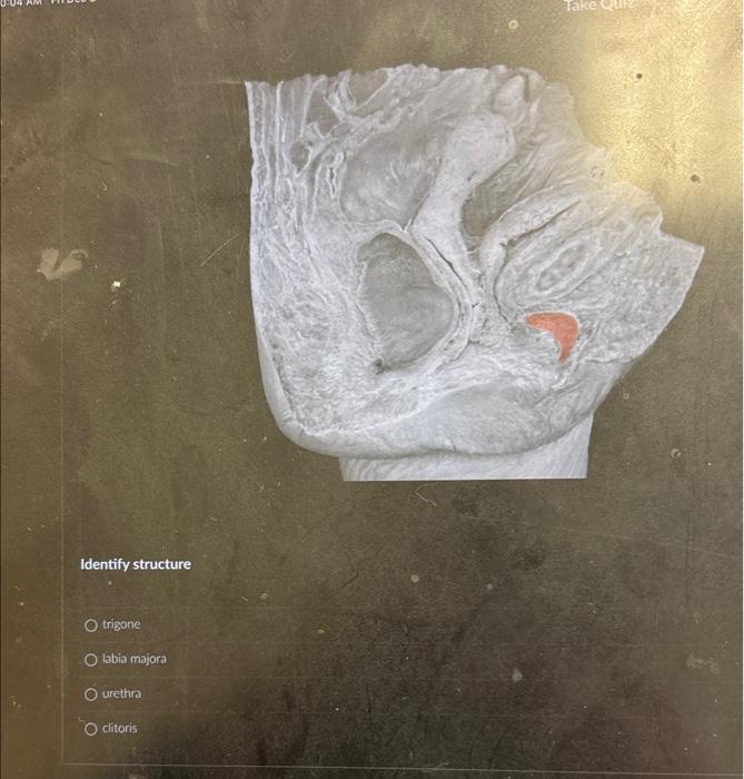 Solved Identify highlighted structure urinary bladder | Chegg.com