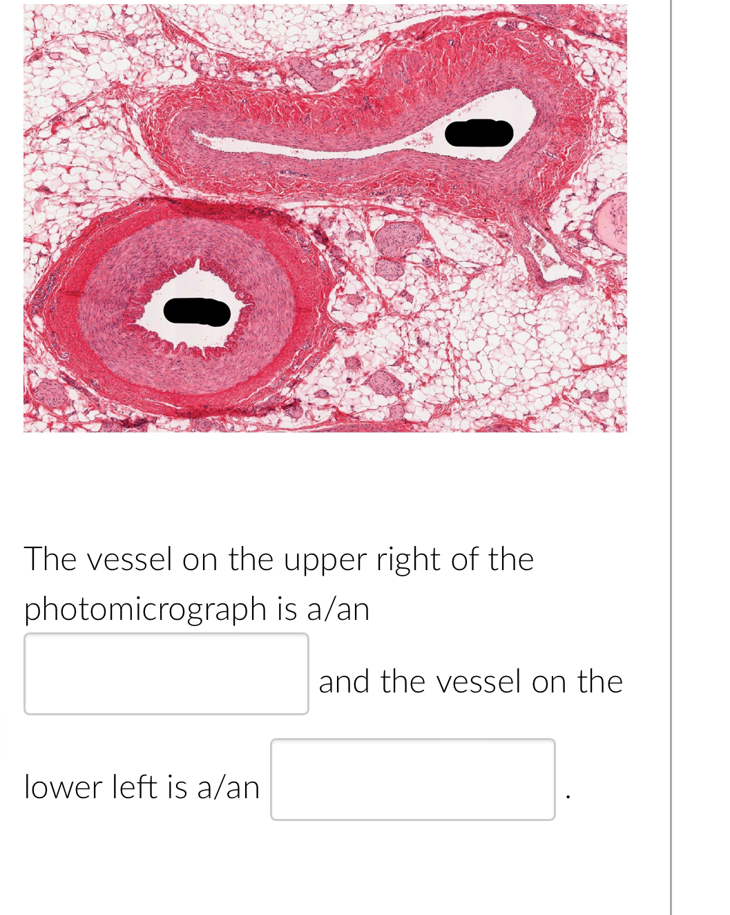 Solved The vessel on the upper right of the photomicrograph | Chegg.com