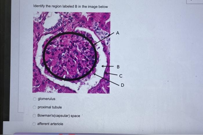 Solved Identify the region labeled B in the image below | Chegg.com