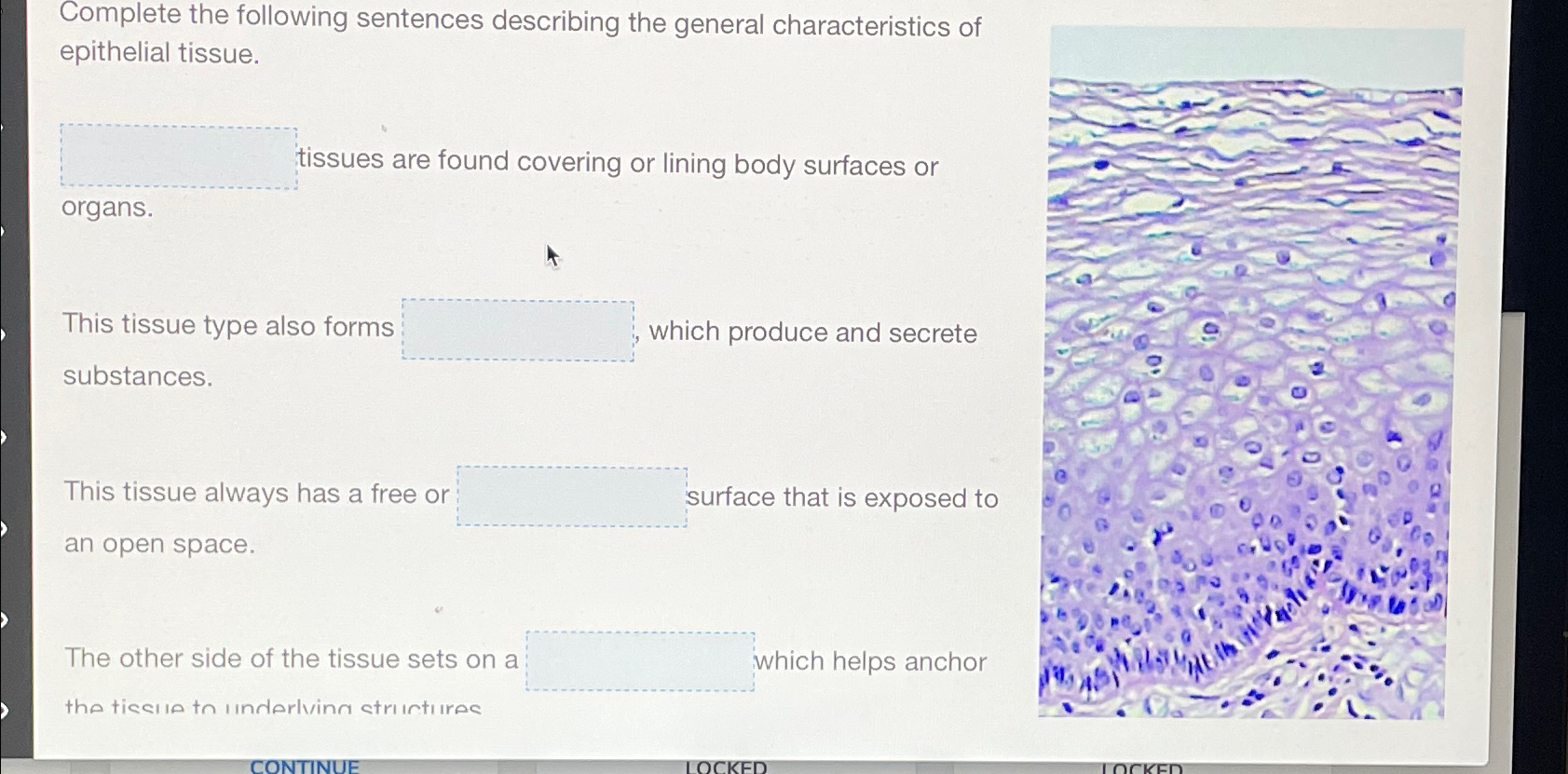 Solved Complete the following sentences describing the | Chegg.com