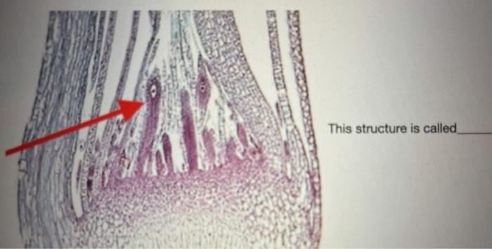 Solved This structure is called This structure is called | Chegg.com