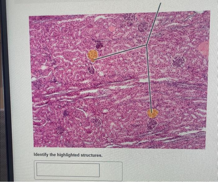 Identity the highlighted structures. Identify the | Chegg.com