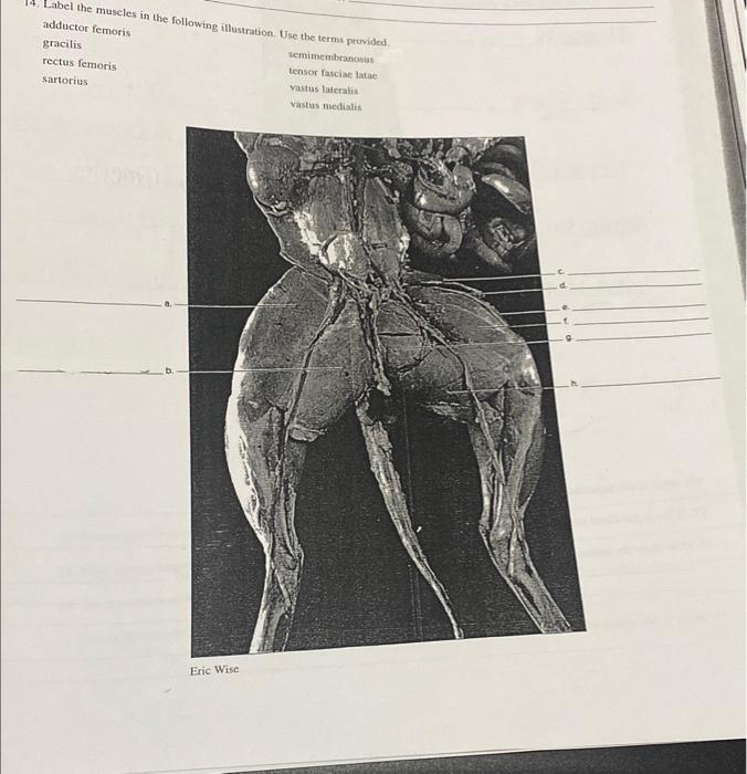 Solved 14. Label the museles in the following illustration. | Chegg.com