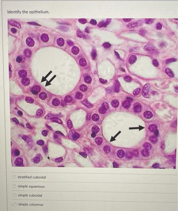 Solved Identify the epithelium. stratified cuboidal simple | Chegg.com