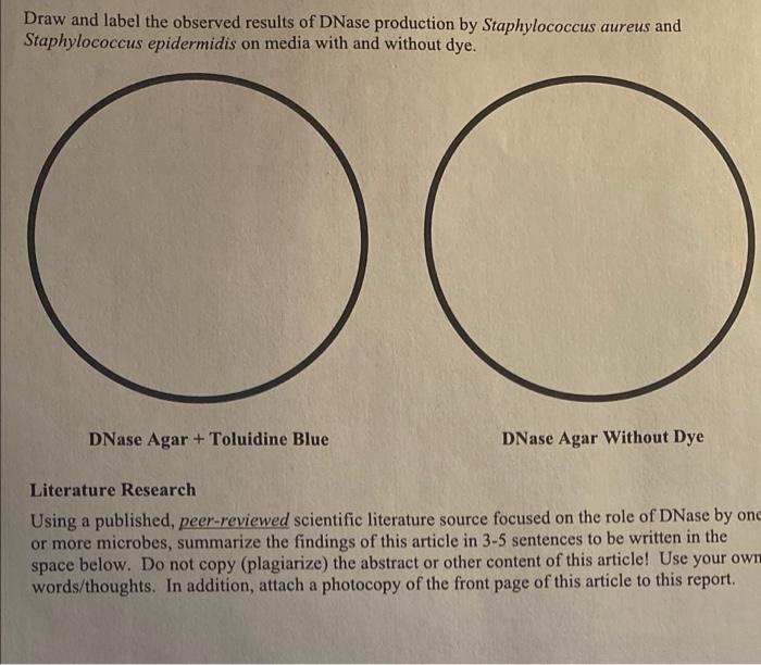 Solved Draw and label the observed results of DNase | Chegg.com