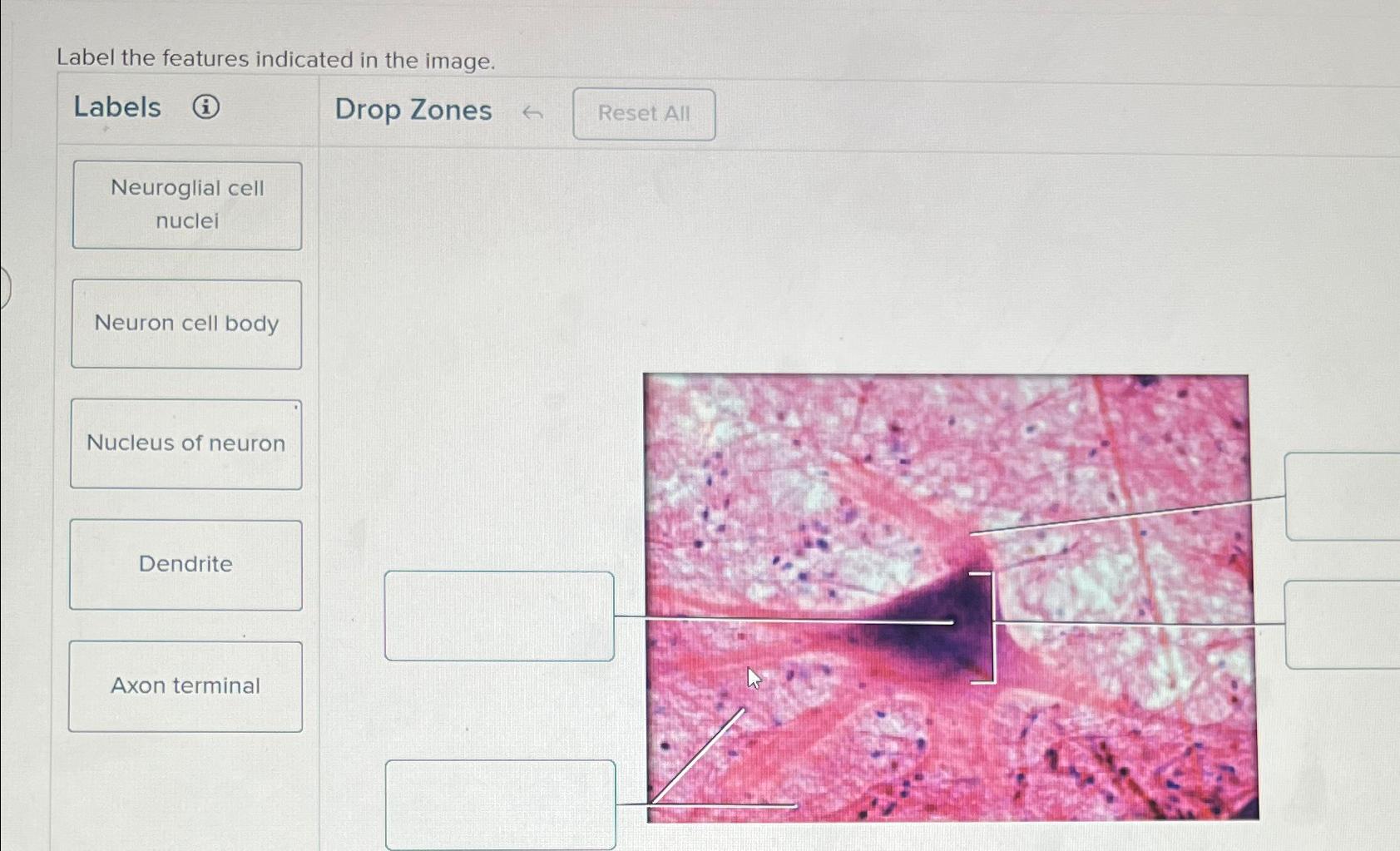 Solved Label the features indicated in the | Chegg.com