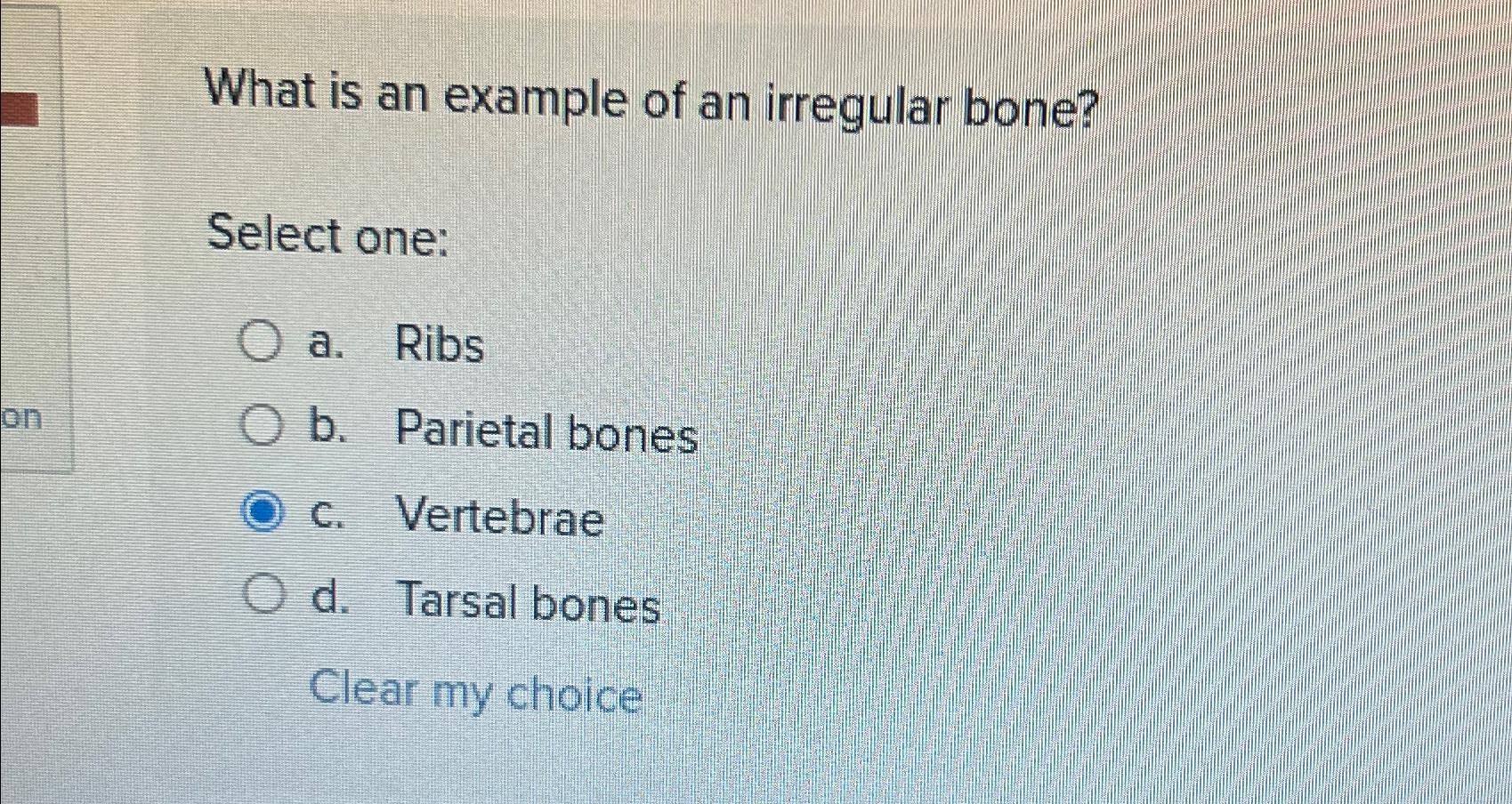 Solved What is an example of an irregular bone?Select one:a. | Chegg.com