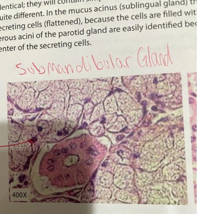 Solved label the mucus acinus, the cell of the mucus acinus, | Chegg.com