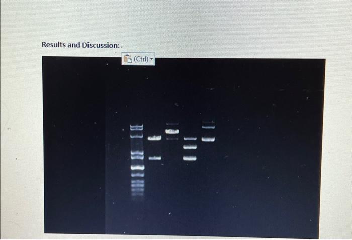 Solved this lab is a plasmid DNA mapping using restriction | Chegg.com