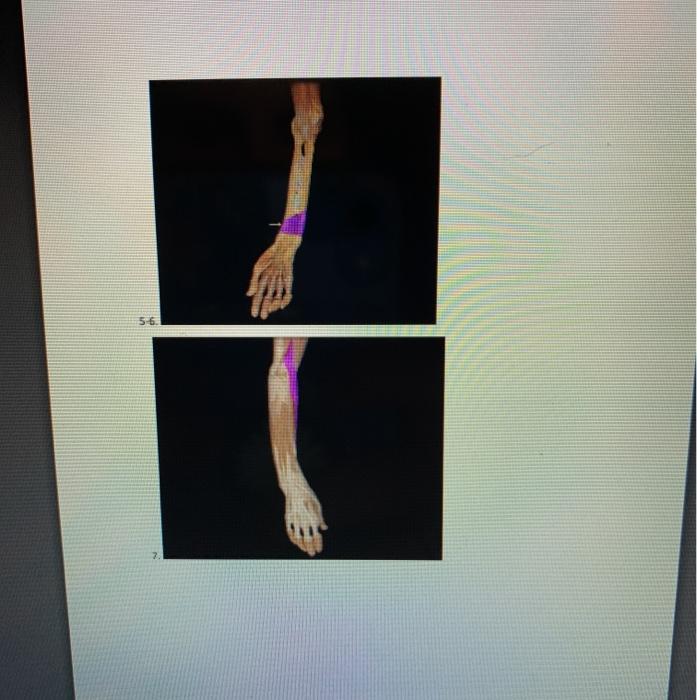 Solved MUSCULAR SYSTEM: FOREARM/EXTRINSIC HAND MUSCLES 1) | Chegg.com