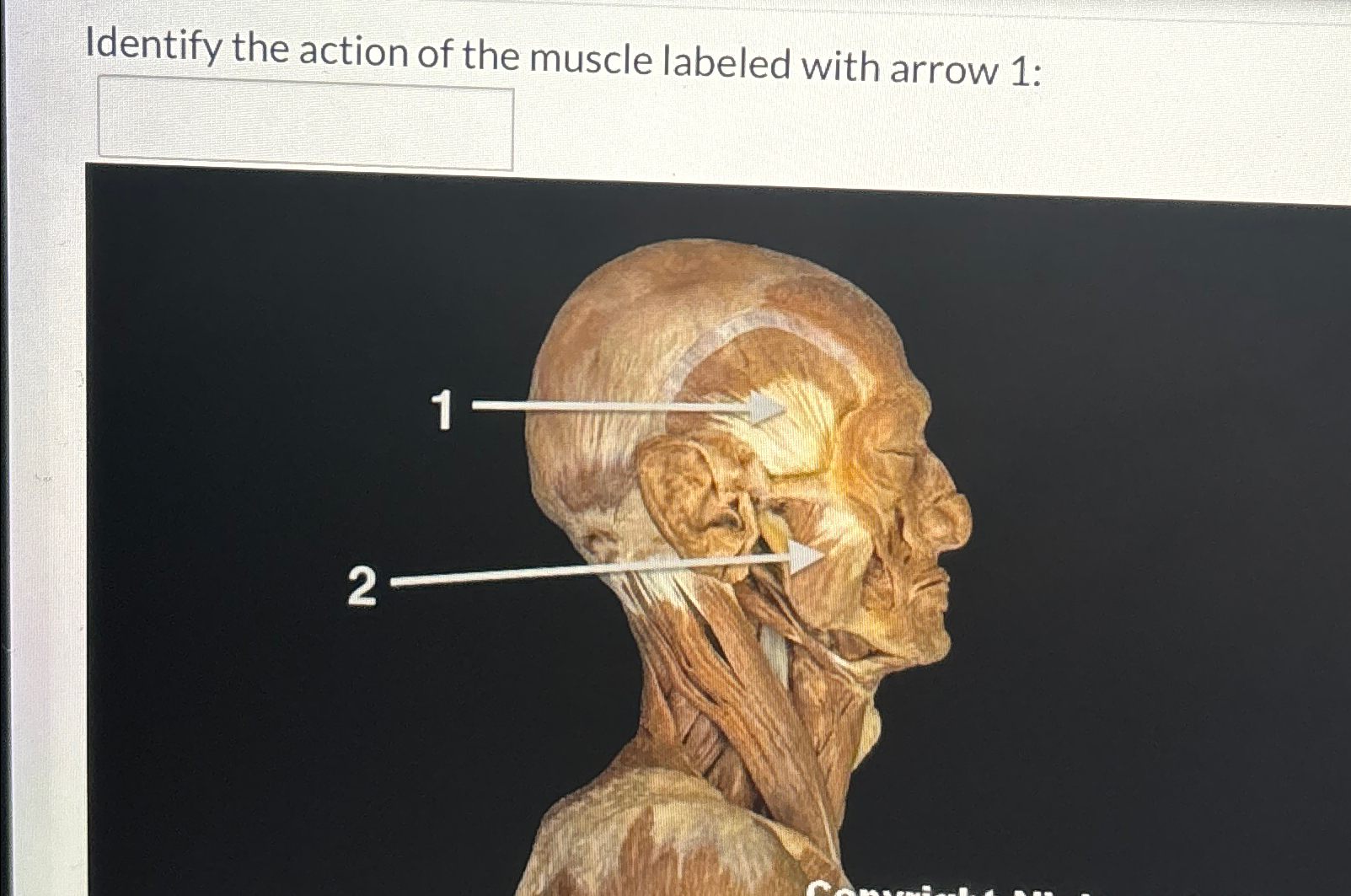 Solved Identify the action of the muscle labeled with arrow | Chegg.com
