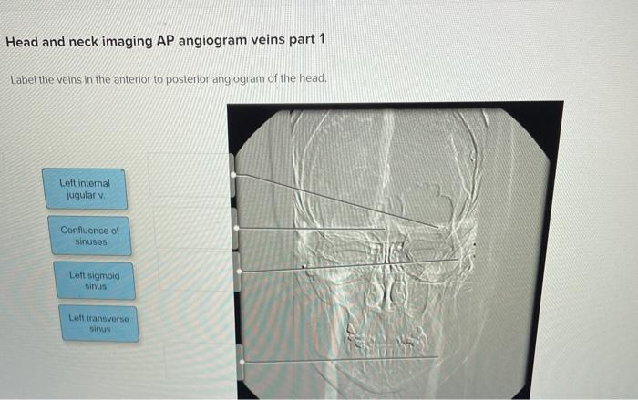 Solved Head and neck imaging AP angiogram veins part 1 Label | Chegg.com