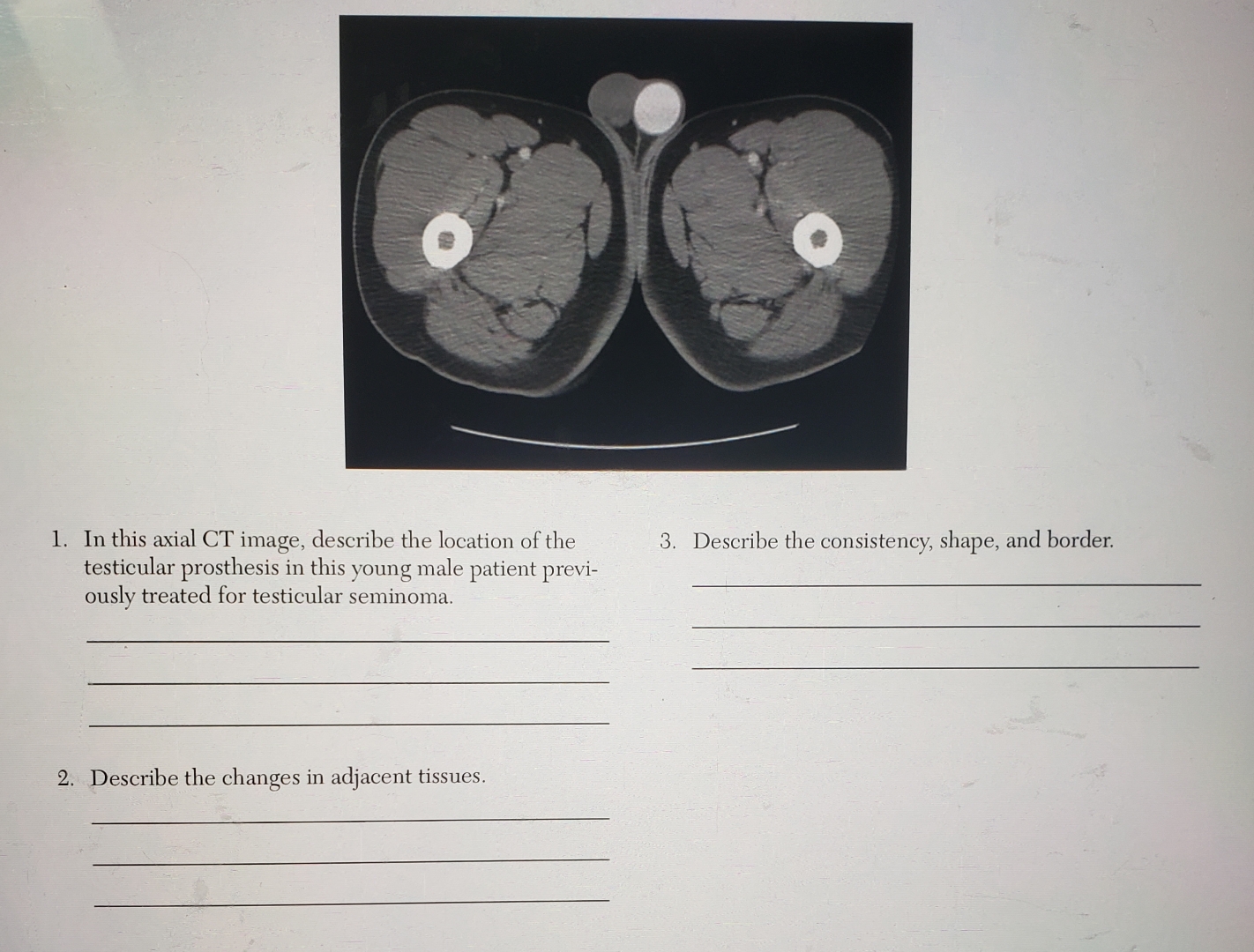 Solved In this axial CT image, describe the location of the | Chegg.com