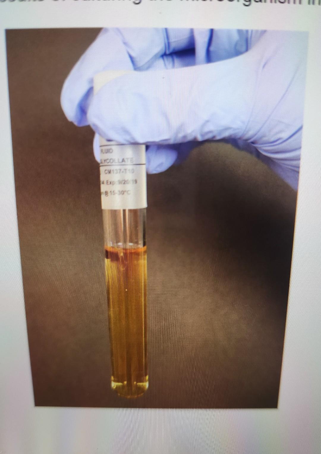 Solved what microorganism species is this? starch test | Chegg.com