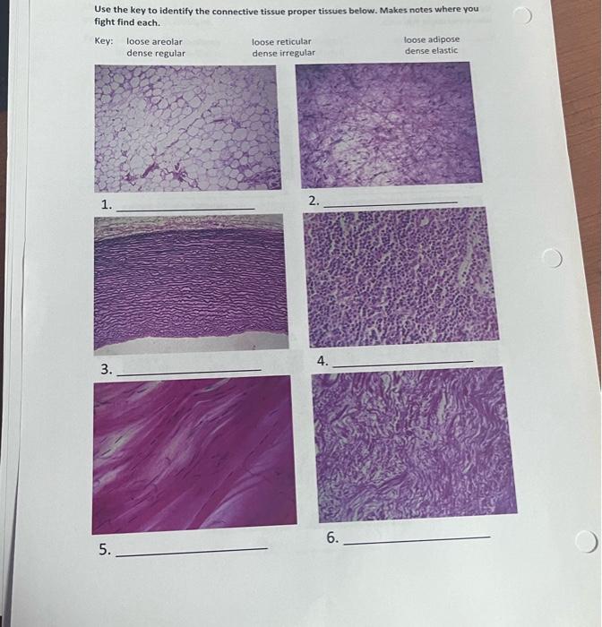 Solved Use the key to identify the connective tissue proper | Chegg.com