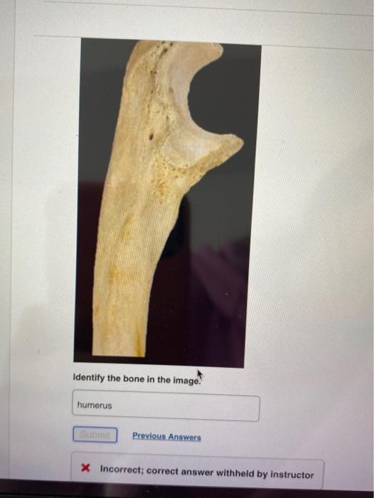 Solved Identify the highlighted structure. Spine process | Chegg.com