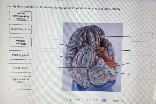 Solved Identify the structures on this inferior lateral view | Chegg.com