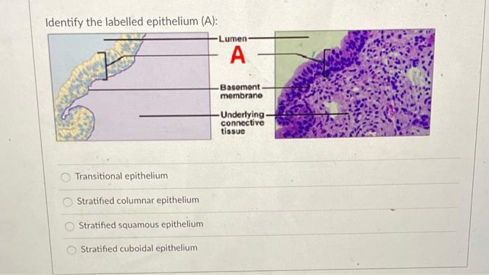Solved Identify the labelled epithelium (A): Simple cuboidal | Chegg.com