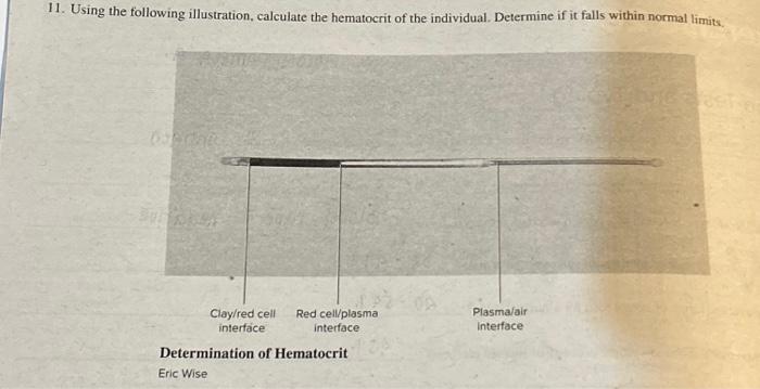 Solved 11. Using the following illustration, calculate the | Chegg.com