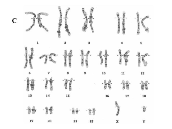 Solved Karyotype Lab Chromosome structure and chromosome | Chegg.com