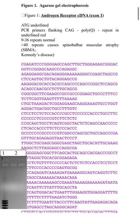 Solved Figure 1: Androgen Receptor CDNA (exon 1) ATG | Chegg.com