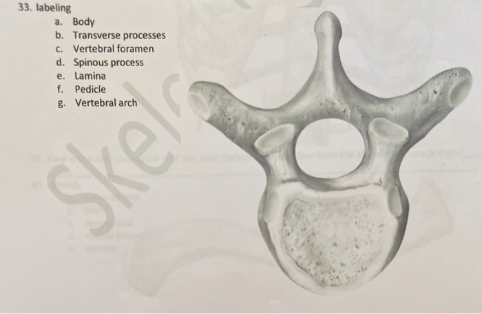 Solved 33. labeling a. Body b. Transverse processes C. | Chegg.com