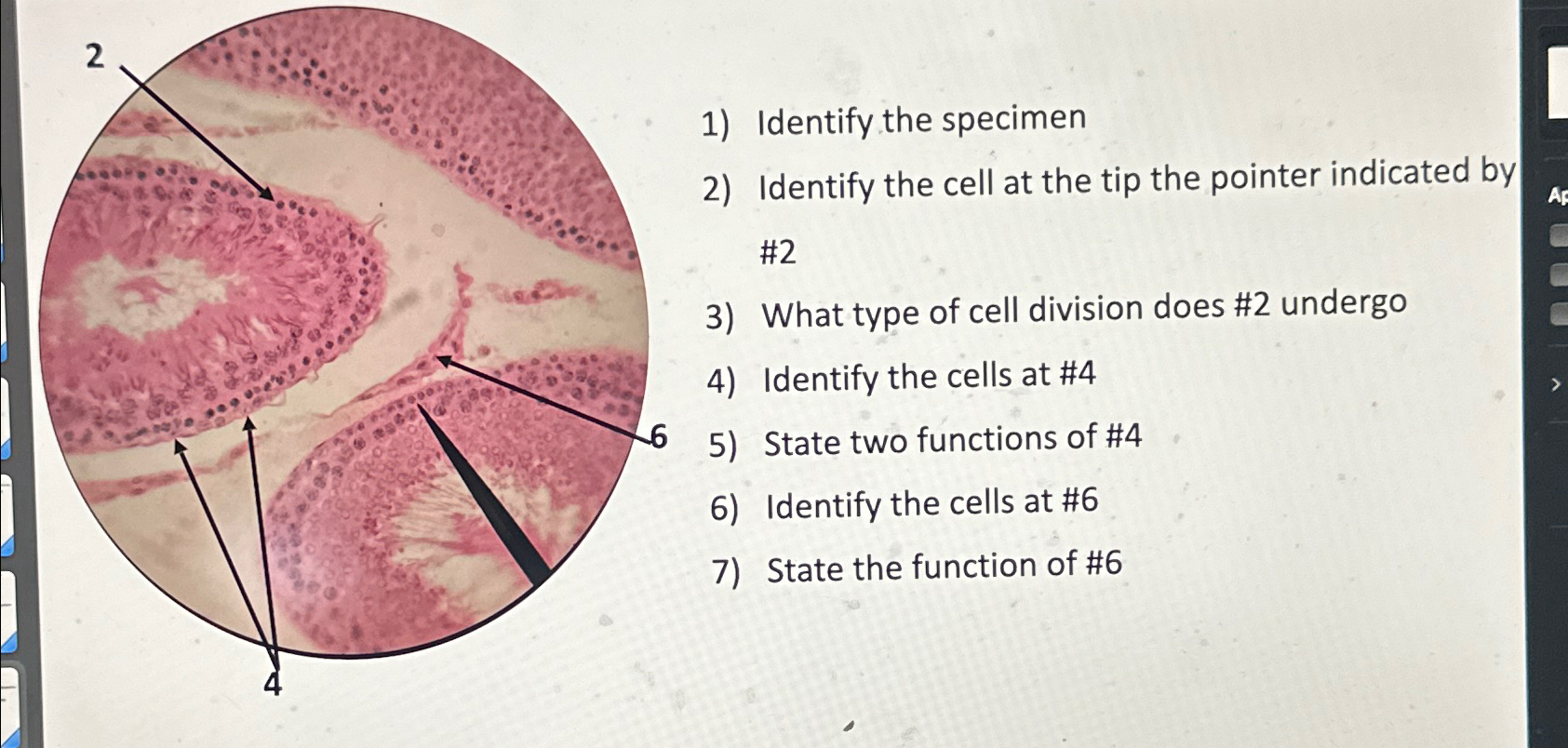 Solved Identify the specimenIdentify the cell at the tip the | Chegg.com