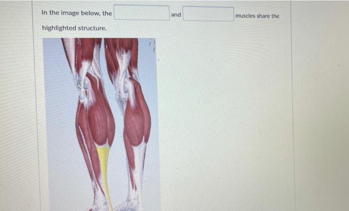 Solved Name the muscle highlighted in orange. Provide one | Chegg.com