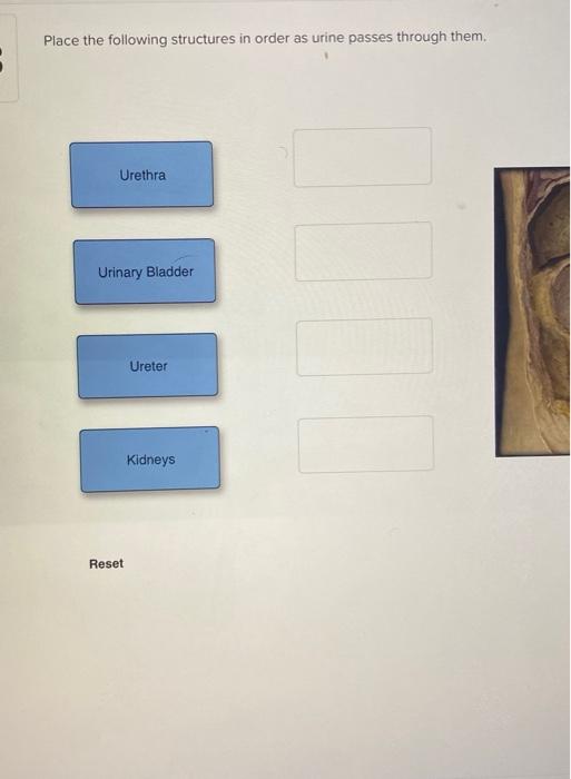 Solved Place the following structures in order as urine | Chegg.com