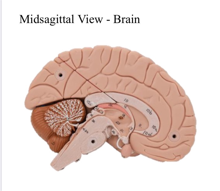 Midsagittal View - Brain 106 10 10 lod 10 | Chegg.com