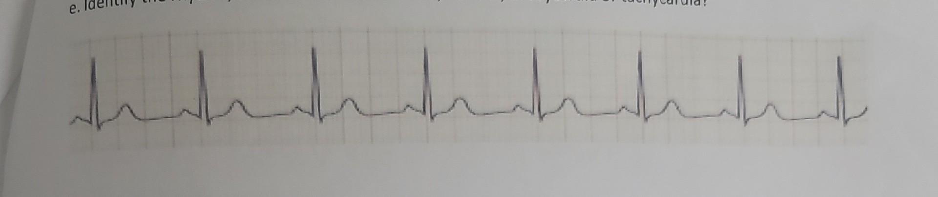 Using the EKG tracing below, a. label P,R,S,T wave, | Chegg.com