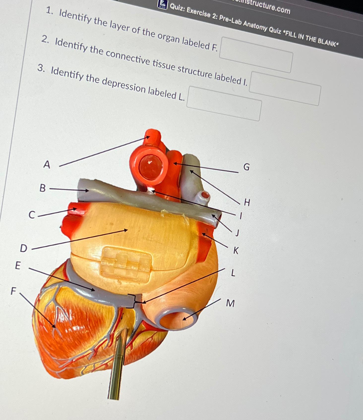 Solved Identify the layer of the organ labeled F.Identify | Chegg.com