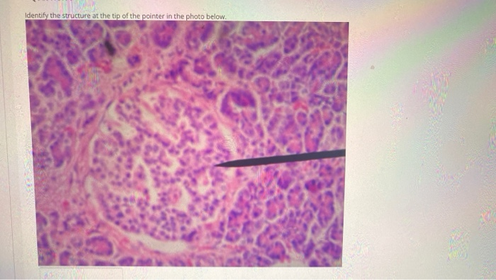 Solved Identify the structure at the tip of the pointer in | Chegg.com