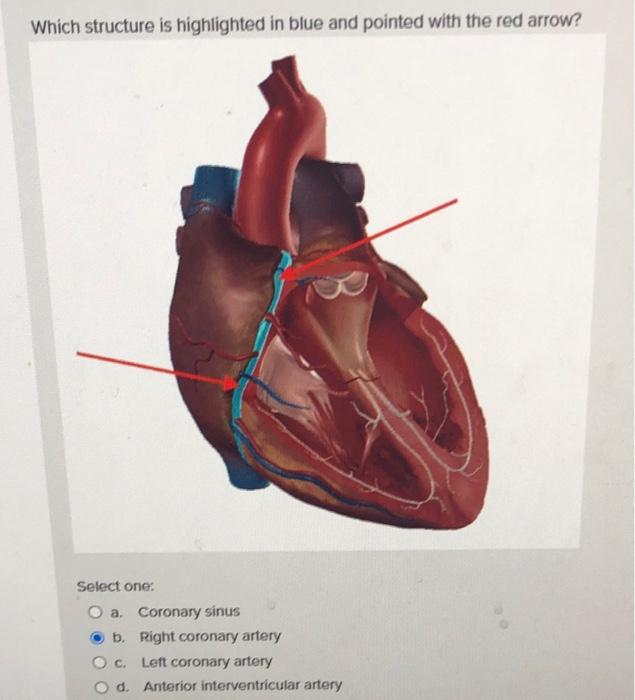 Solved Identify the left atrium of the heart. A D Select | Chegg.com