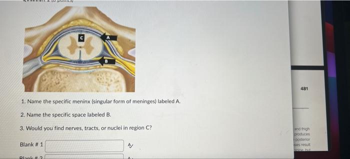Solved J 1. Name the specific meninx (singular form of | Chegg.com